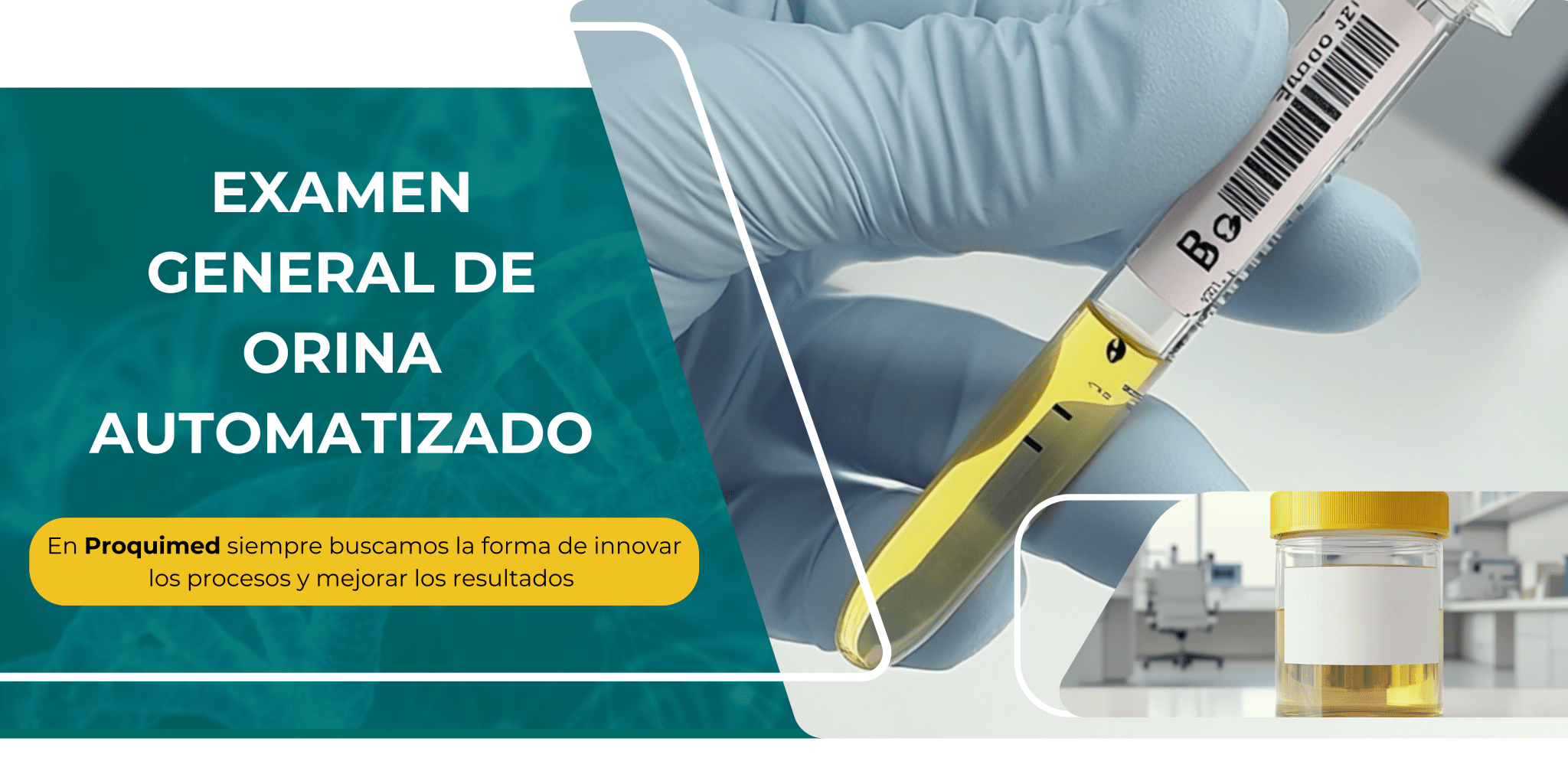Examen General de Orina Automatizado | Proquimed Laboratorio Clínico